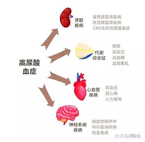 尿酸高这些事情最好不要做不然会引发大问题 知乎