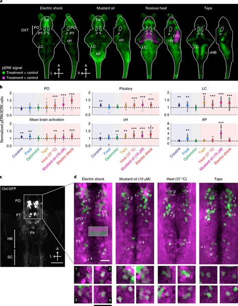 Brain Wide Responses To Noxious And Aversive Stimuli A Whole Brain