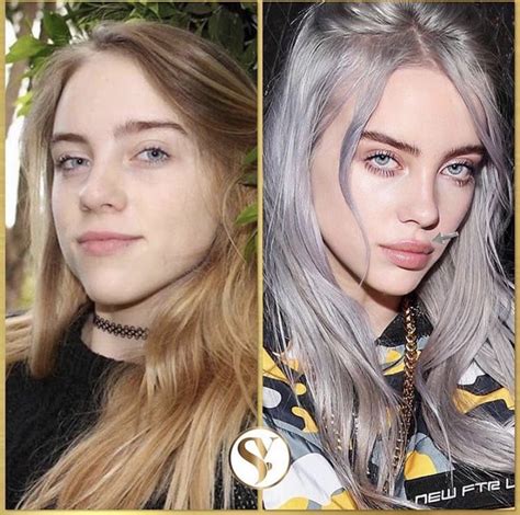 Did Billie Eilish Undergo Plastic Surgery Including Boob Job Nose Job