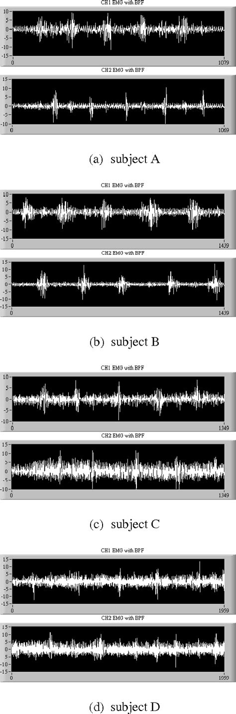 Figure 1 From An Adaptive Upper Arm Emg Based Robot Control System
