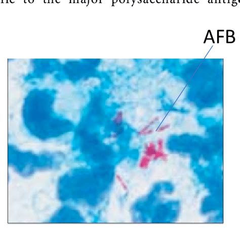 Image Showing Microscopic Picture Of Acid Fast Bacilli Red Sharp Download Scientific Diagram