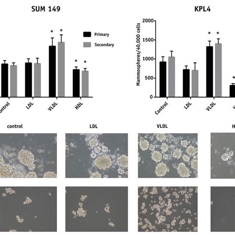 In Vitro Detection Of Cholesterol Levels In Sum 149 Cells By Filipin