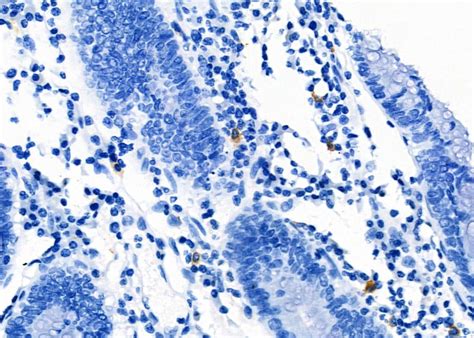 Slc7a5 Antibody Pa5 115916