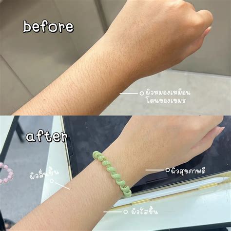 ดีจริงหรือจกตา วิตามิน Vital Iv 🫧🧐 แกลเลอรีที่โพสต์โดย เรียกเราว่า