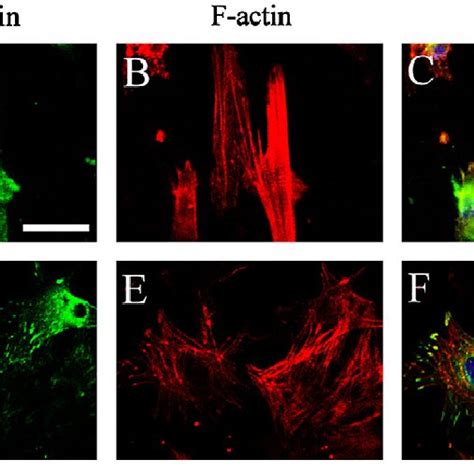 Immunofluorescence Staining Of Focal Contacts And Vinculin Formation On