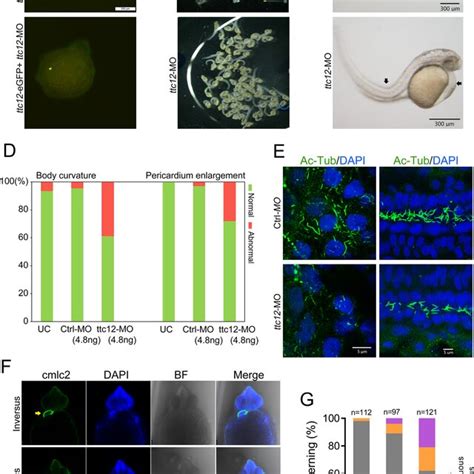 TTC12 Knockdown Causes Defective LR Patterning In Zebrafish Embryos A Download Scientific