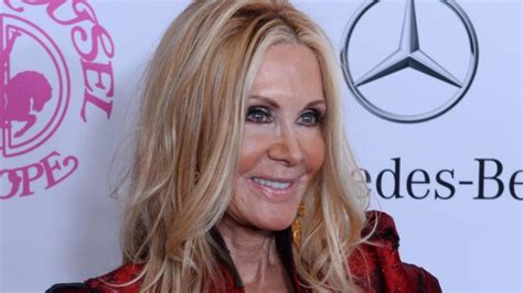 Joan Van Ark Plastic Surgery The Knots Landing Star Then And Now