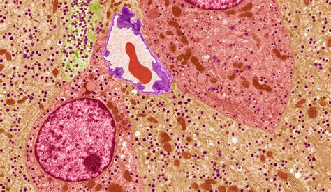 Glucagon Blocking Antibodies Restore β Cells In Diabetes Model