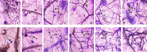 Microscopic Observation Of Podosphaera Xanthii Infection In Pumpkin