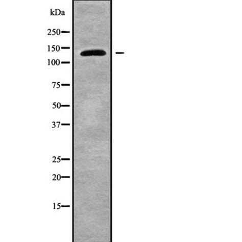 Hcn4 Polyclonal Antibody Pa5 104030