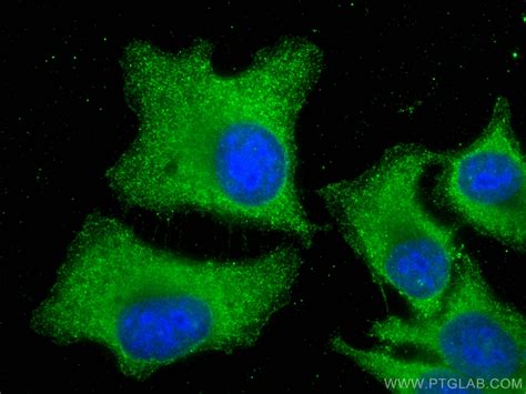 Fgfr3 Antibody 66954 1 Ig Proteintech