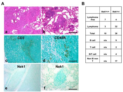 Spontaneous Lymphoid Tumors In Nek1 Mice Nek1 And Wild Type