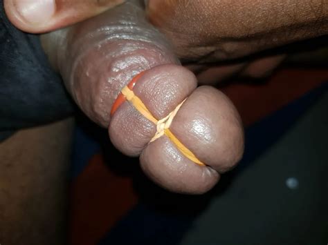 Rubber Bands On My Glans 6 Nude Pics Xhamster