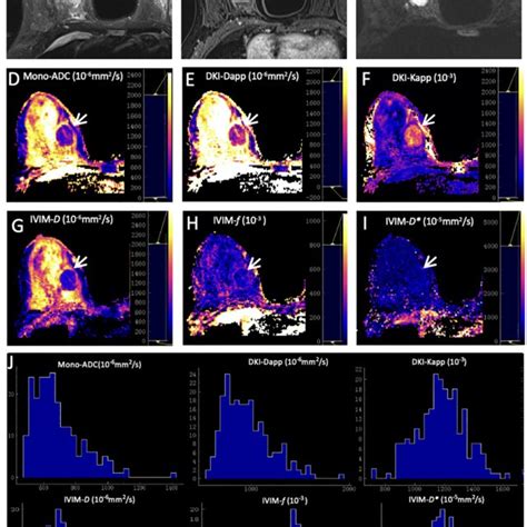 Sequence Parameters For T2 Weighted Imaging Sms Rs Epi And Dce Mri