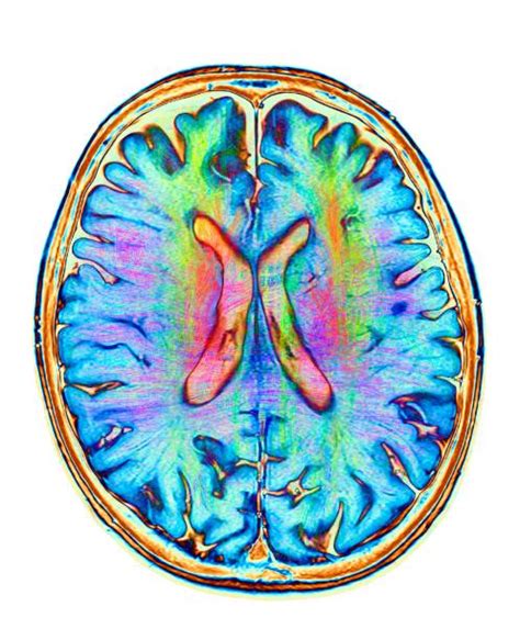 6 445 Mri Brain Scan Photos And Premium High Res Pictures Getty