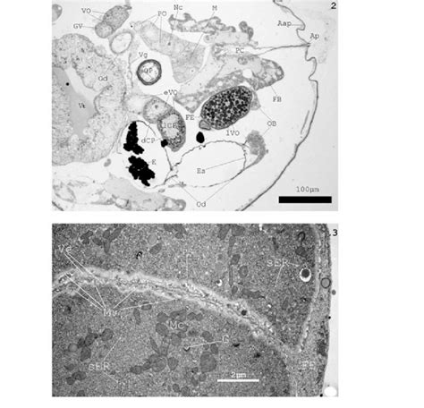 Light Microscopy Image Of Parafrontal Semithin Sectioning Through