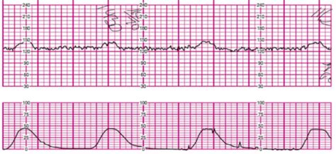 OB Exam 3 Flashcards Quizlet