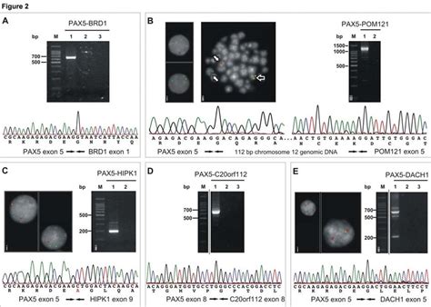 Fish Rt Pcr Race And Sequence Analyses Of Pax5 Rearranged Patients