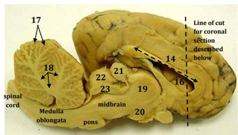 Sheep Brain Midsagittal Diagram Quizlet Sheep Brain Midsagittal Diagram Quizlet