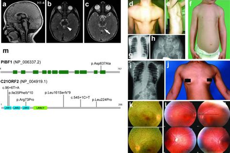 An Sirna Based Functional Genomics Screen For The Identification Of