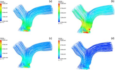 Velocity Streamlines Produced By Cfd Simulation For The Neo Pulmonary