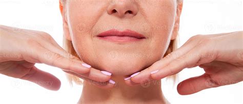 Middle Age Close Up Woman Face Before After Cosmetic Procedures Skin