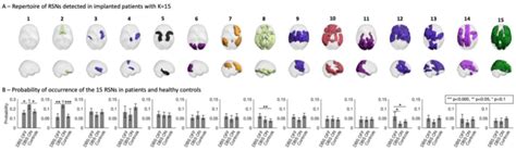 The 15 Rsns Identified In The Patients Fmri Data A The Repertoire Of