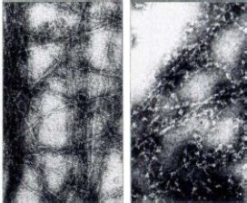Exam 2 Part B1 Actin Binding Proteins And Their Role In Cell Motility
