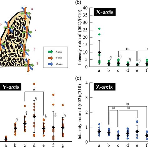 Presence Of A Significant Increase In Volume In The Left Masseter