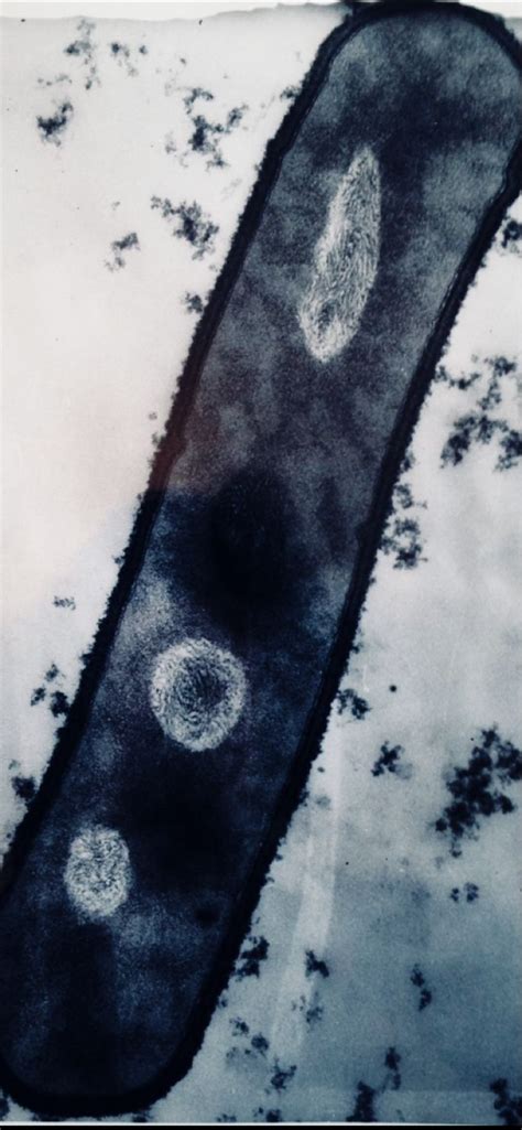 Bacillus Subtilis Embark On A Captivating Exploration Into The Realm Of Microbiology With