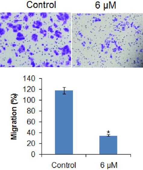 Scutellarin Induced Dose Dependent Inhibition Of Cell Migration In K562