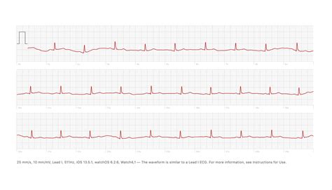 Classification With High Interpretability Hybrid Thinking Doing By Michael Mallari