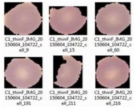 Figure 3 From Malaria Cell Image Classification Using Deep Learning Semantic Scholar