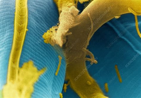 Arthrobotrys Oliospora Stock Image C009 4118 Science Photo Library