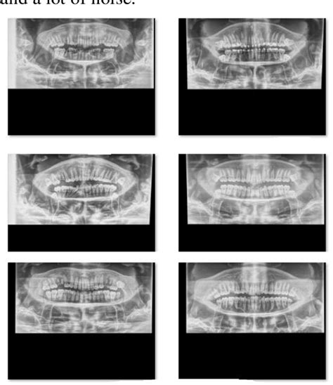 Figure 3 From Segmentation And Counting The Number Of Teeth Panoramic Dental Image Semantic