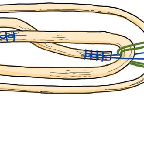 Schematic Diagram Demonstrating The Technique Of Preparing The 5 Strand