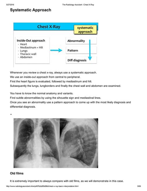 The Radiology Assistant Chest X Ray Basic Interpretation Pdf