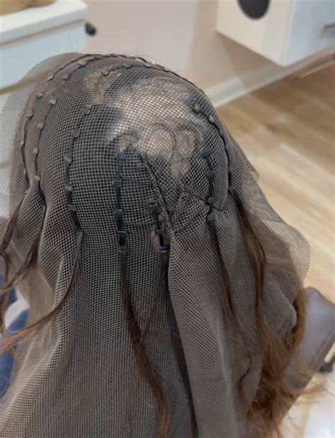 mesh integration hair system your solution to hair loss — b bauer