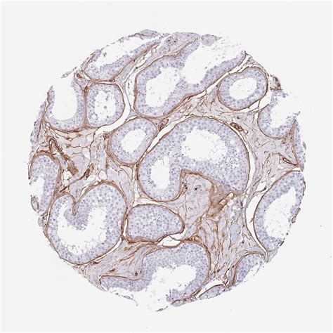 Tissue Expression Of Cd34 Staining In Testis The Human Protein Atlas