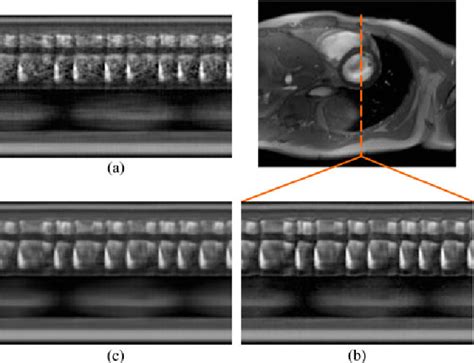 Figure 9 From High Resolution Cardiovascular Mri By Integrating