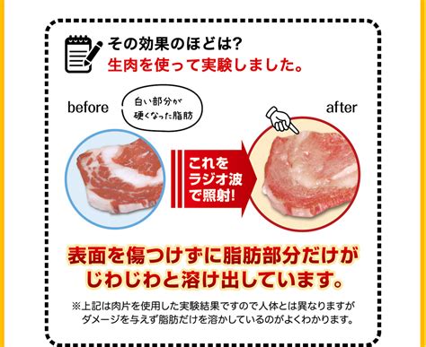 セルライト撃退コースエステサロン FAVORIX GROUP
