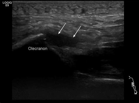 Preoperative Ultrasound Diagnostic Download Scientific Diagram