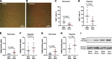 Transcriptomics And Proteomics Revealed Sex Differences In Human Pulmonary Microvascular
