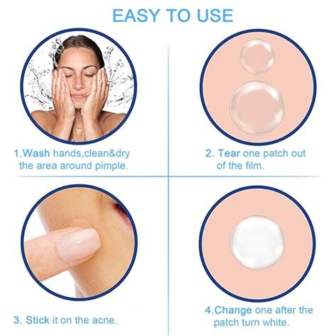 Ultra Thin Daily Pressure Acne Patch Manufacturer China Acne And