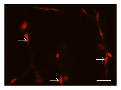 Resveratrol Downregulates The Expression Of Cxcr4 In Pc12 Cells Treated