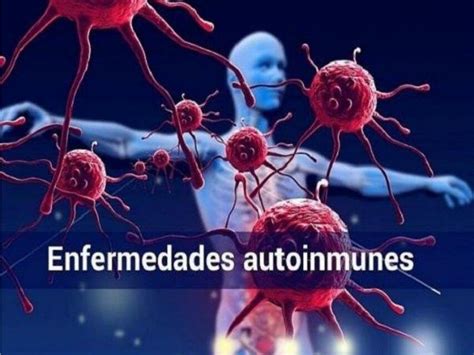Enfermedades Autoinmunes RESÚMENES MÉDICOS uDocz