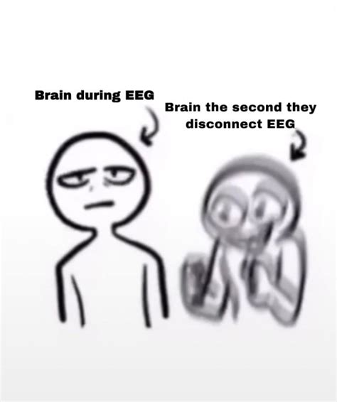 265 Best R Epilepsymemes Images On Pholder Brain Connectivity Problems
