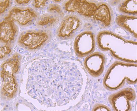 Syntaxin 3 Rabbit Mab Sab Signalway Antibody