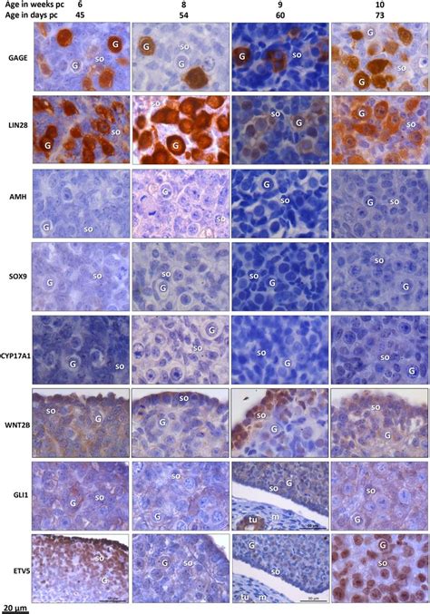 Immunohistochemical Detection Of Specific Markers In Human Embryonic