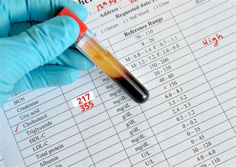 Diabetes And Dyslipidemia Are All Both Treatable Once You Decide On It